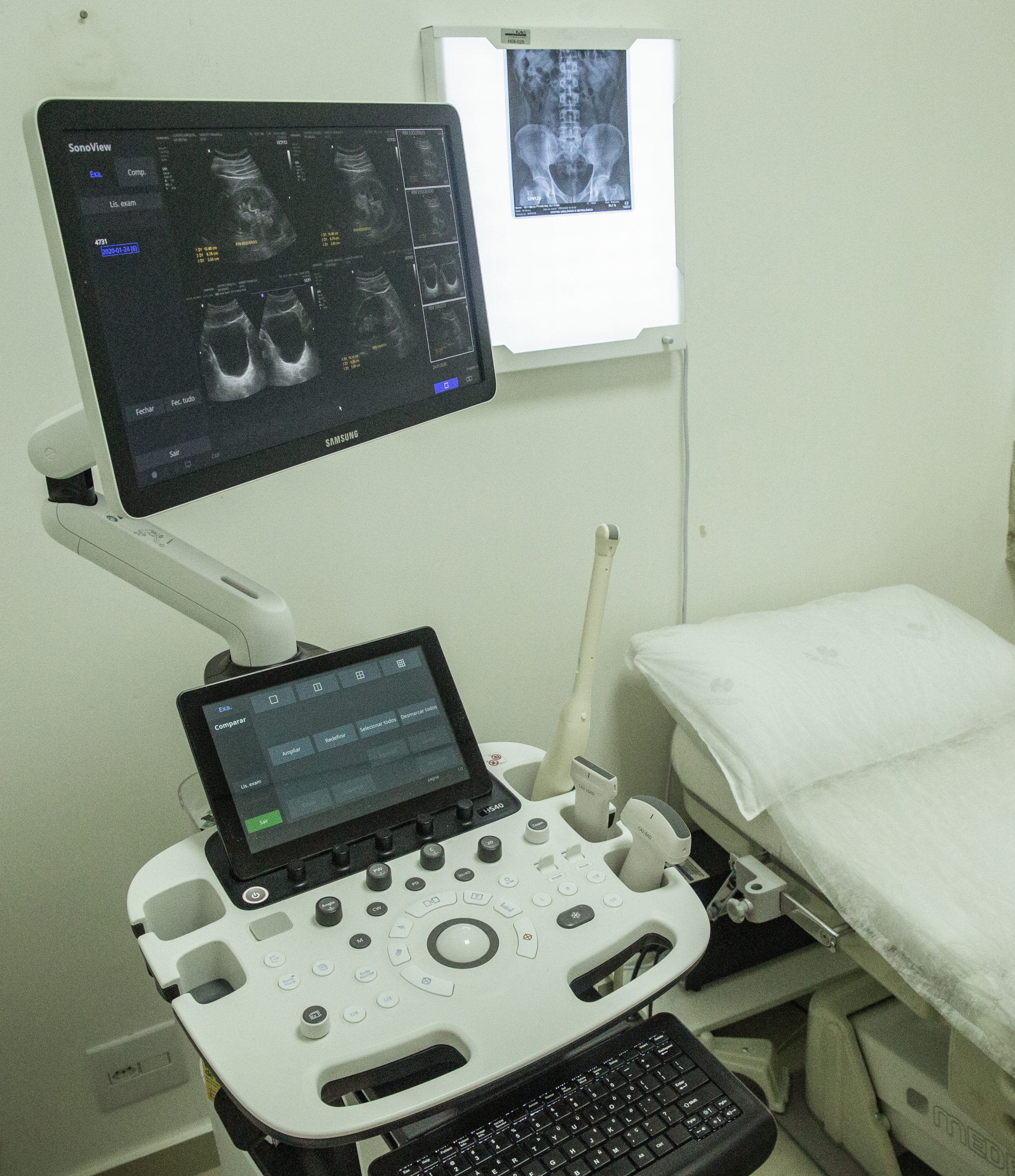 Ultrassonografia - Urologico Mogi